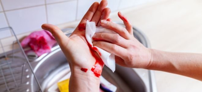 What Are the Top Kitchen Safety Hazards? | DoItYourself.com