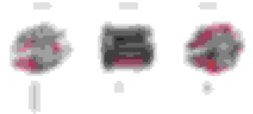 KR: Understanding the torque distribution principle of the Audi Torsen ...